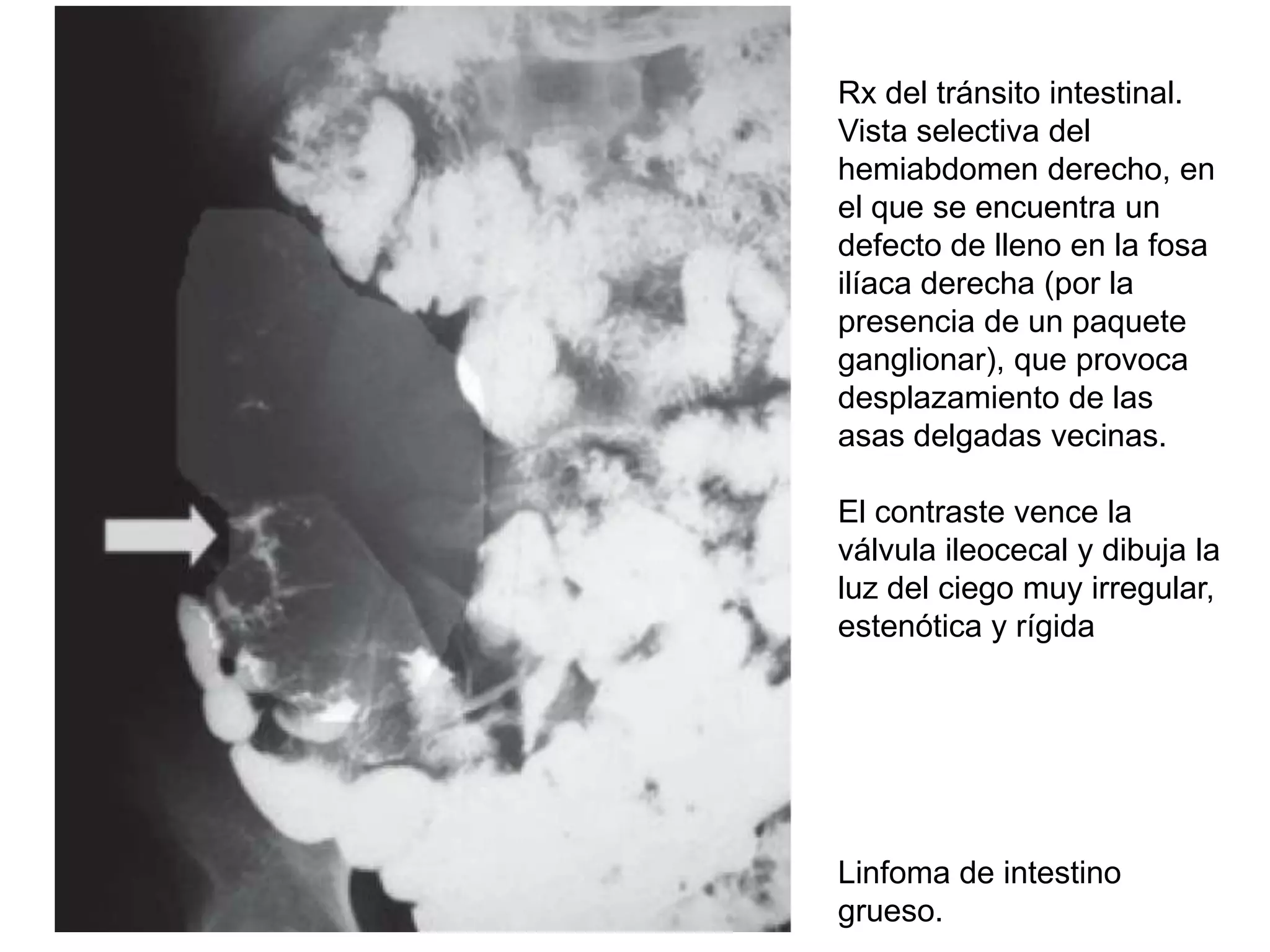 Transito intestinal | PPTX