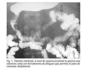 Transito intestinal | PPTX