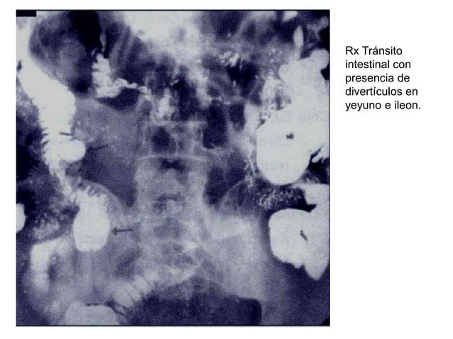 Transito intestinal | PPTX