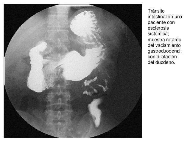 Transito intestinal
