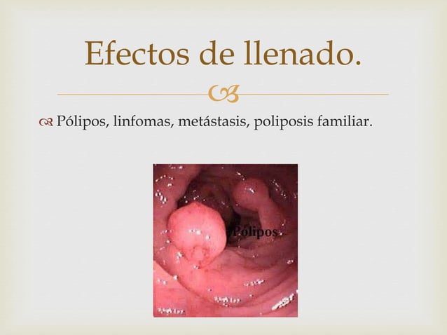 Transito intestinal | PPTX