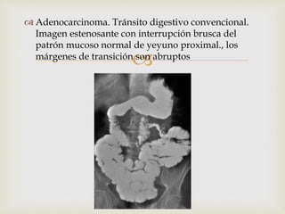 Transito intestinal | PPTX