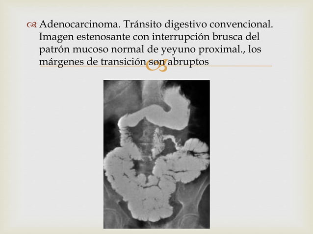 Transito intestinal | PPTX