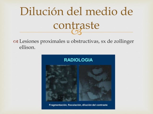Transito intestinal | PPTX