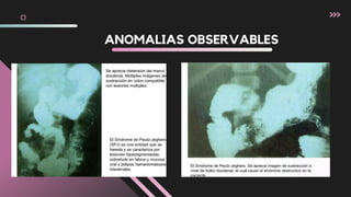 transito intestinal, colon por edema .pdf