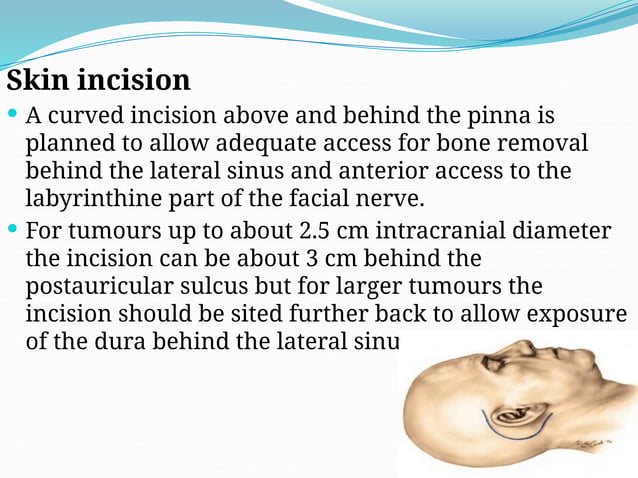 Translabyrinthine approaches for IAM.pptx