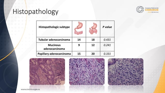 PHYSIOLOGIC VS NON-PHYSIOLOGICANASTOMOSIS AFTER SUBTOTAL GASTRECTOMIES ...