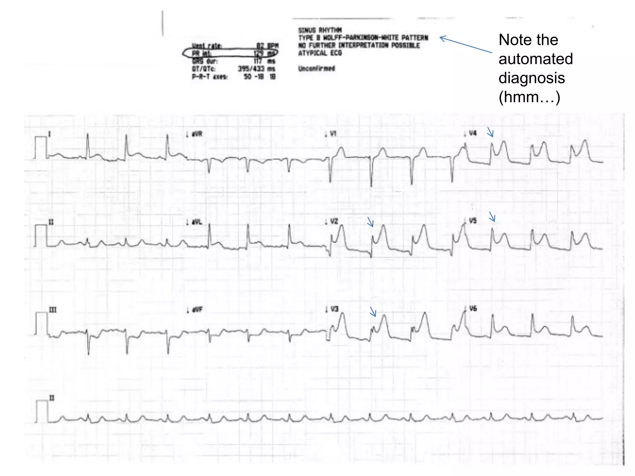 Translating into Clinical Practice: NASA 12-lead ECG Inventions for ...