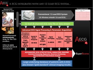 Translating into Clinical Practice: NASA 12-lead ECG Inventions for ...