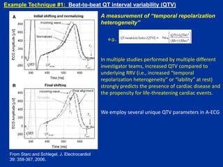 Translating into Clinical Practice: NASA 12-lead ECG Inventions for ...