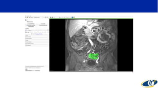 Toward Personalized Surgery | PPT