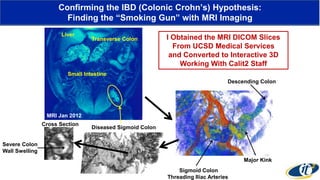 Toward Personalized Surgery | PPT