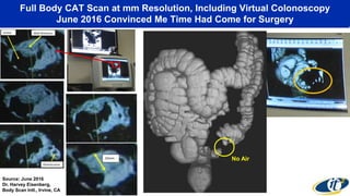 Toward Personalized Surgery | PPT