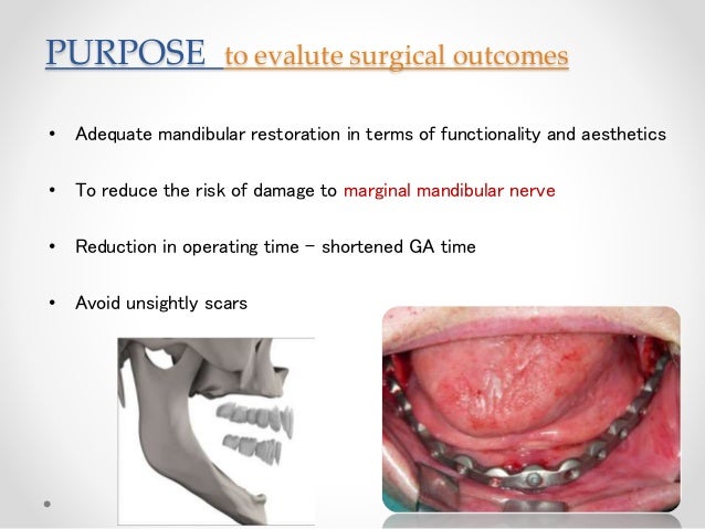 Intra-oral Extra-Mucosal Fixation of Atrophic Mandible