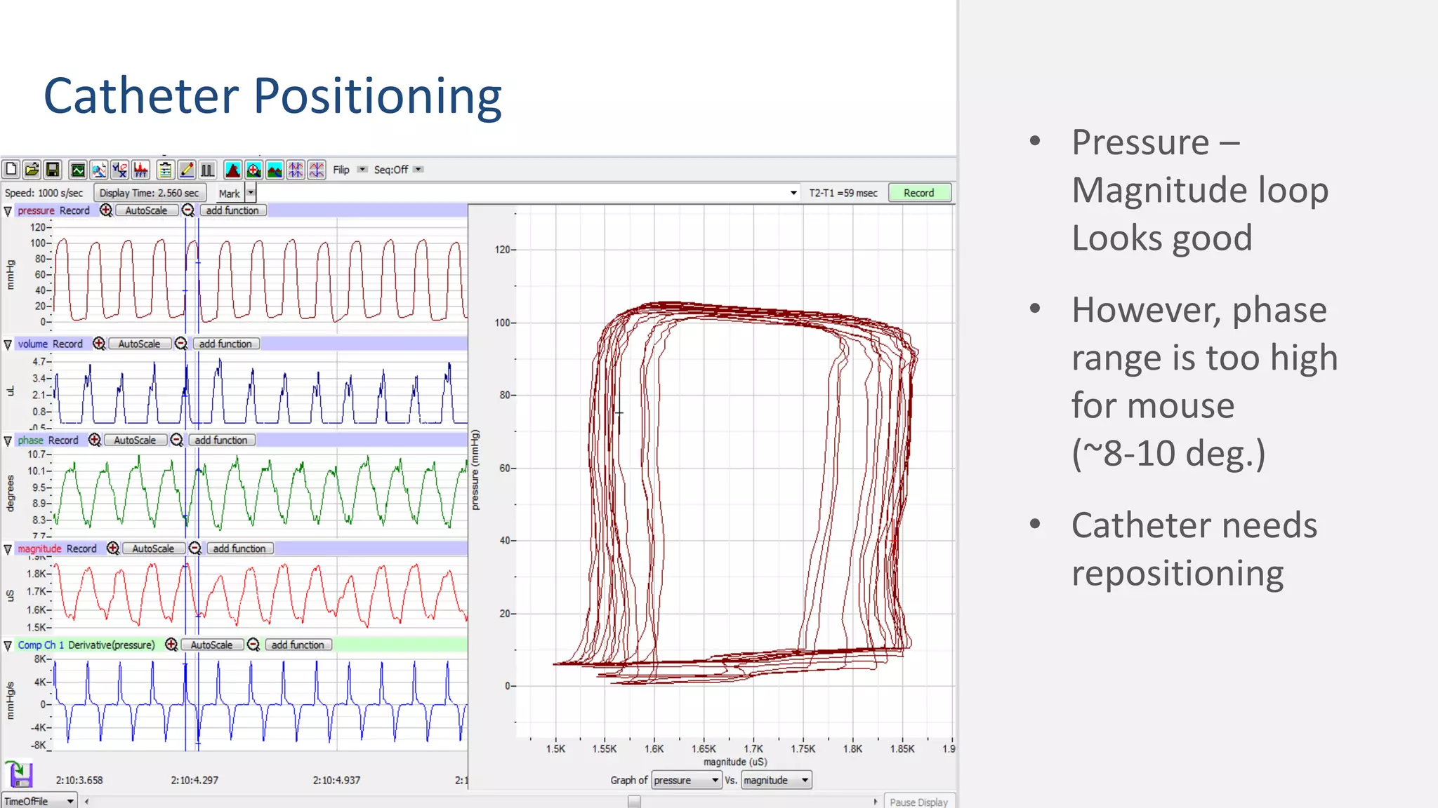 Best-Practices to Achieve Quality PV Loop Data | PDF
