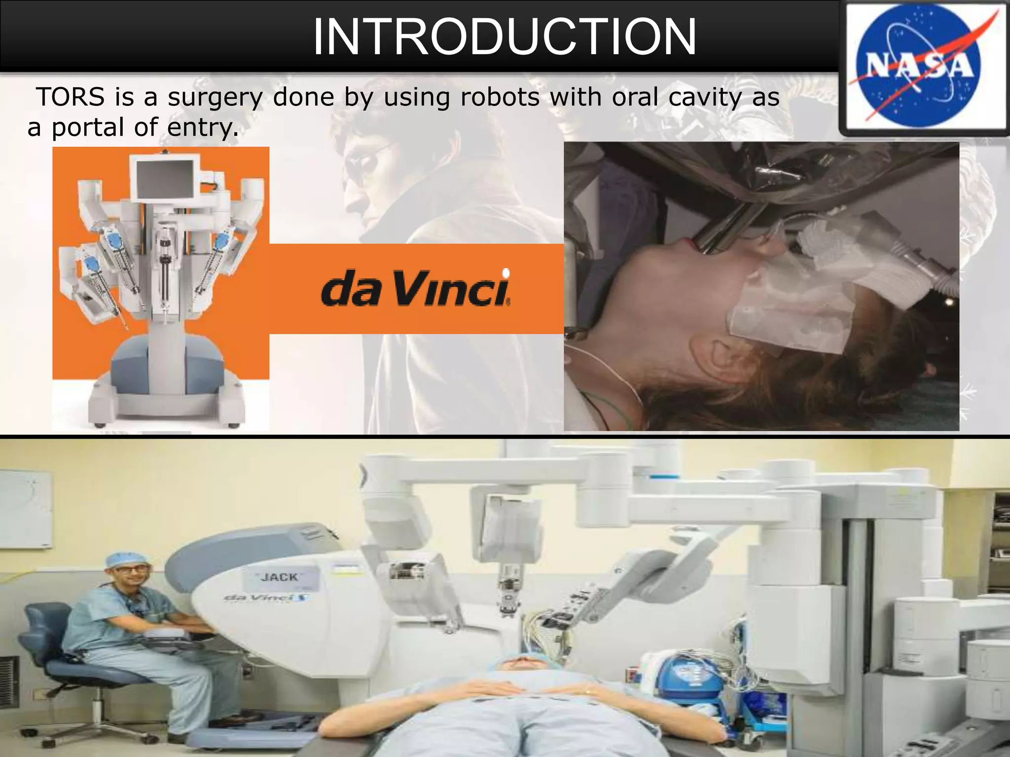 Transoral robotic surergy-TORS - A REVIEW | PPTX