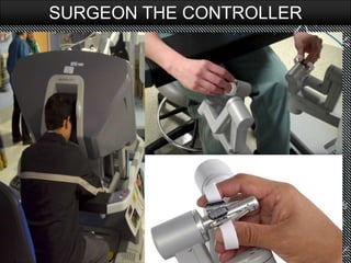 Transoral robotic surergy-TORS - A REVIEW | PPTX