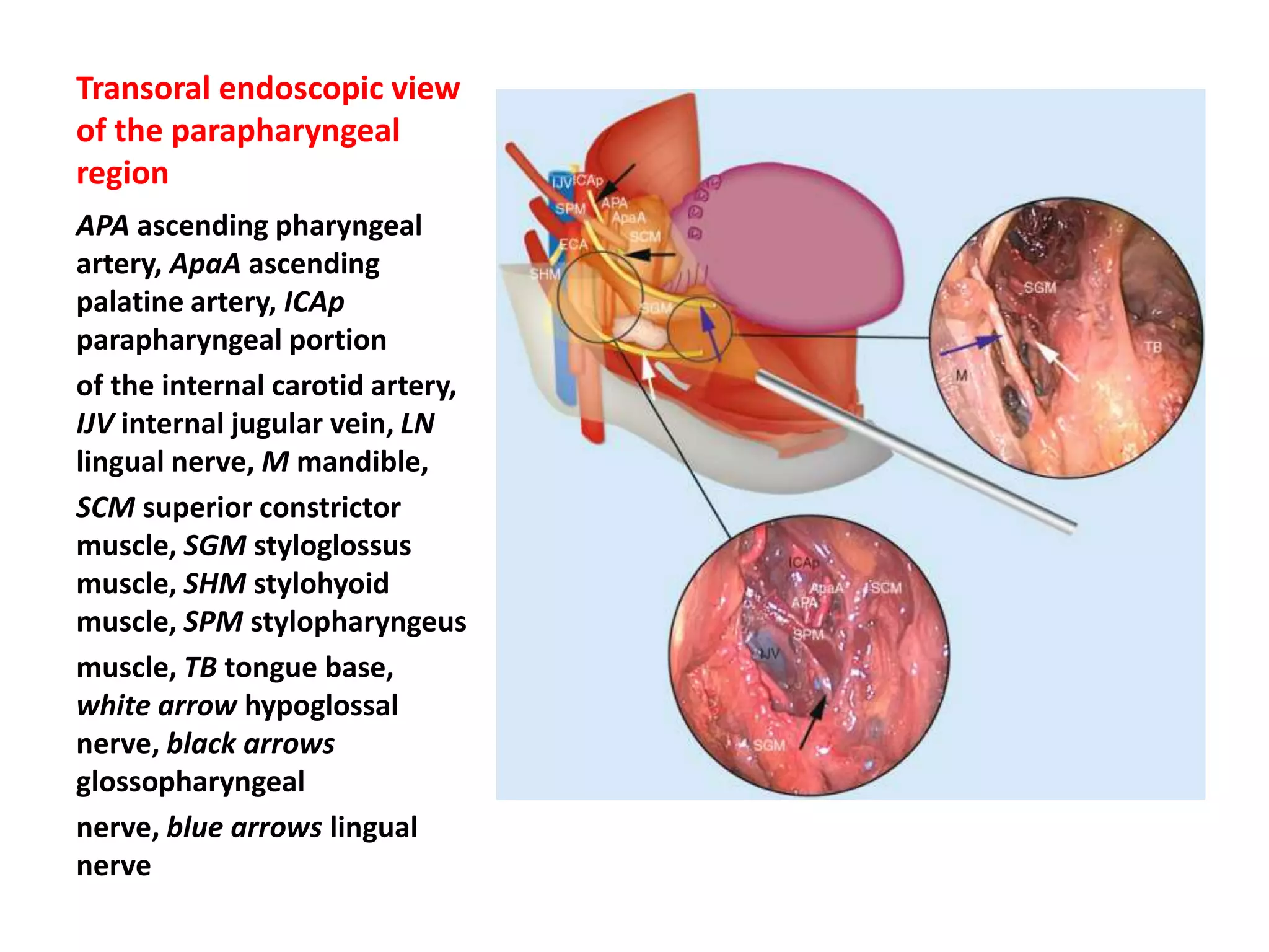 Transoral & Transorbital approaches of skull base | PPTX