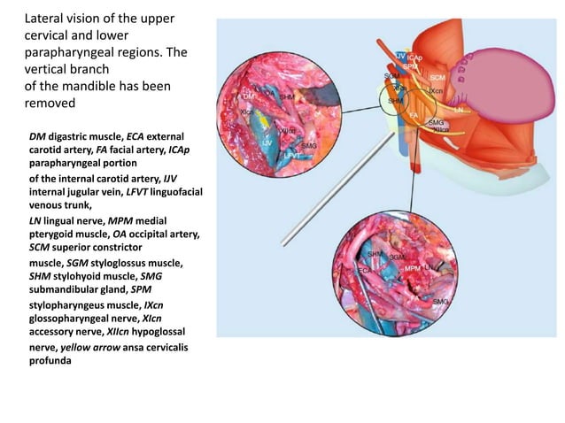 Transoral & Transorbital approaches of skull base | PPTX