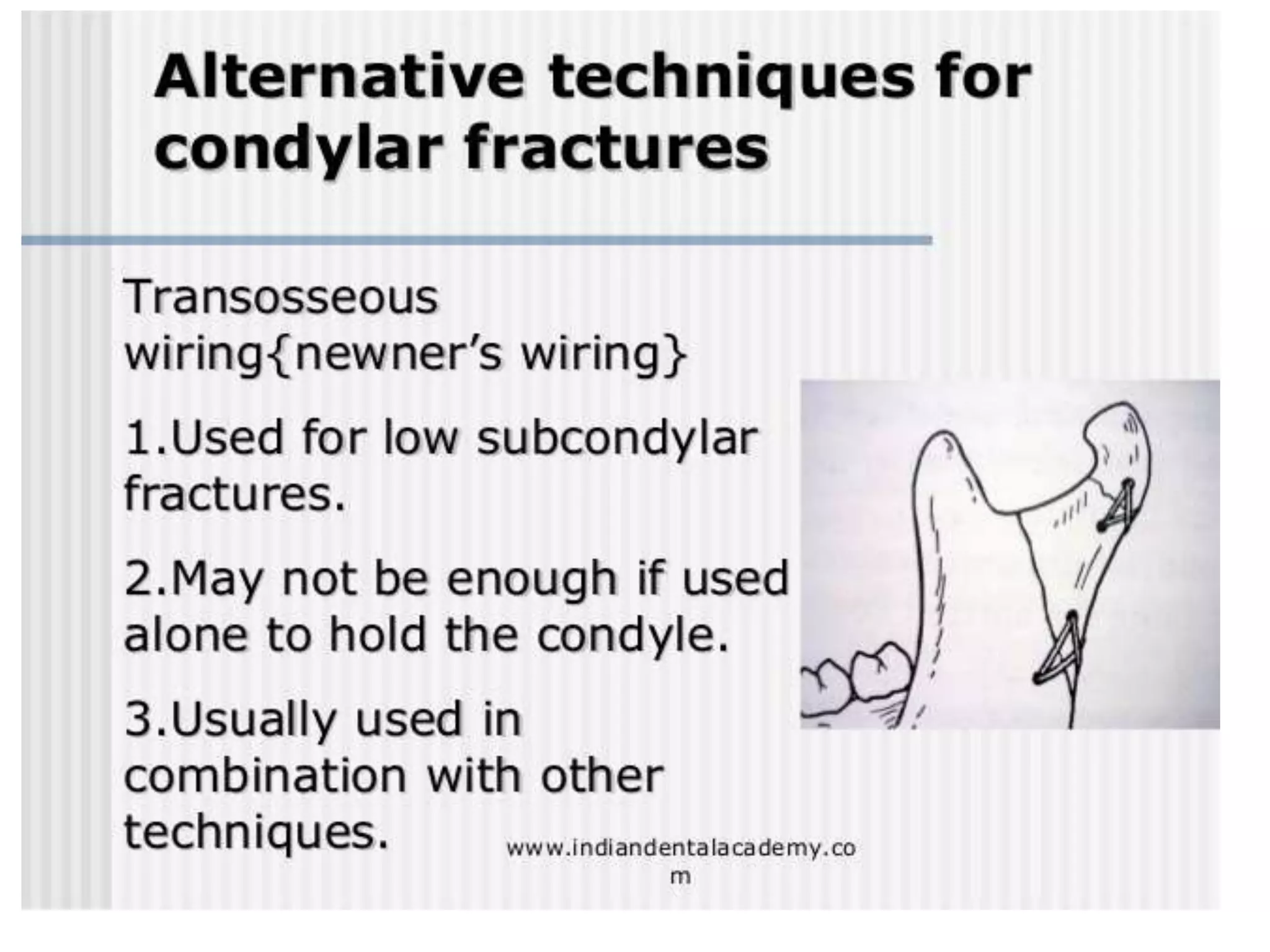 Transosseus wiring circumferential wiring dentoalveolar fracture | PPTX ...