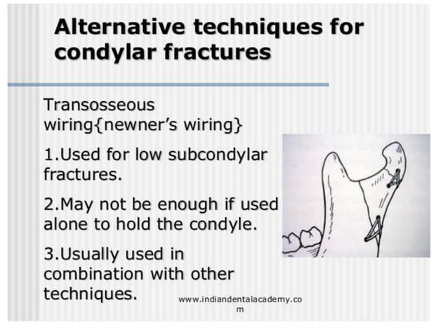 Transosseus wiring circumferential wiring dentoalveolar fracture | PPTX ...