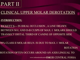 Transpalatal arch for molar rotation | PPT