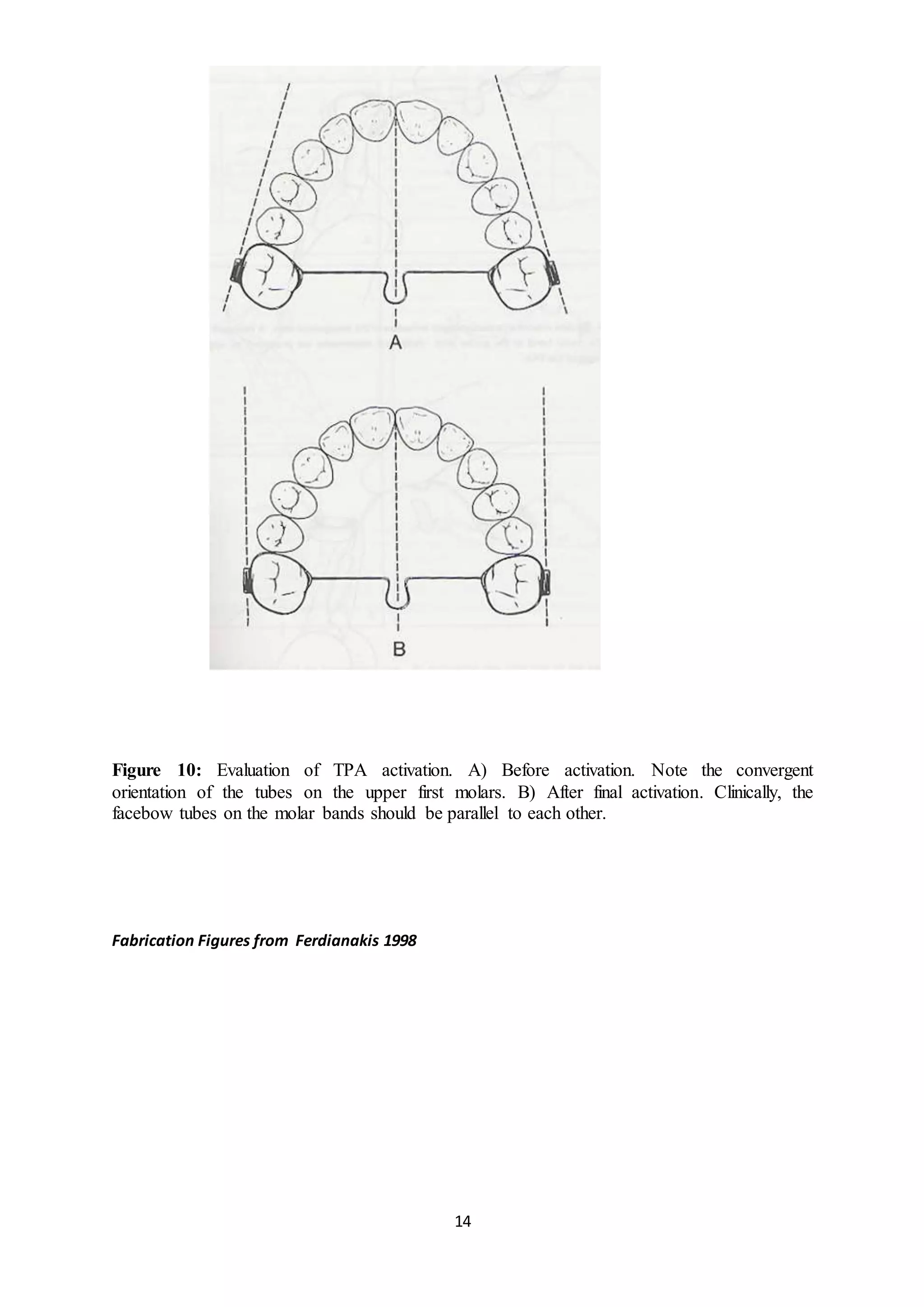 Transpalatal, nance, lingual arch, quadhelix appliances for ...