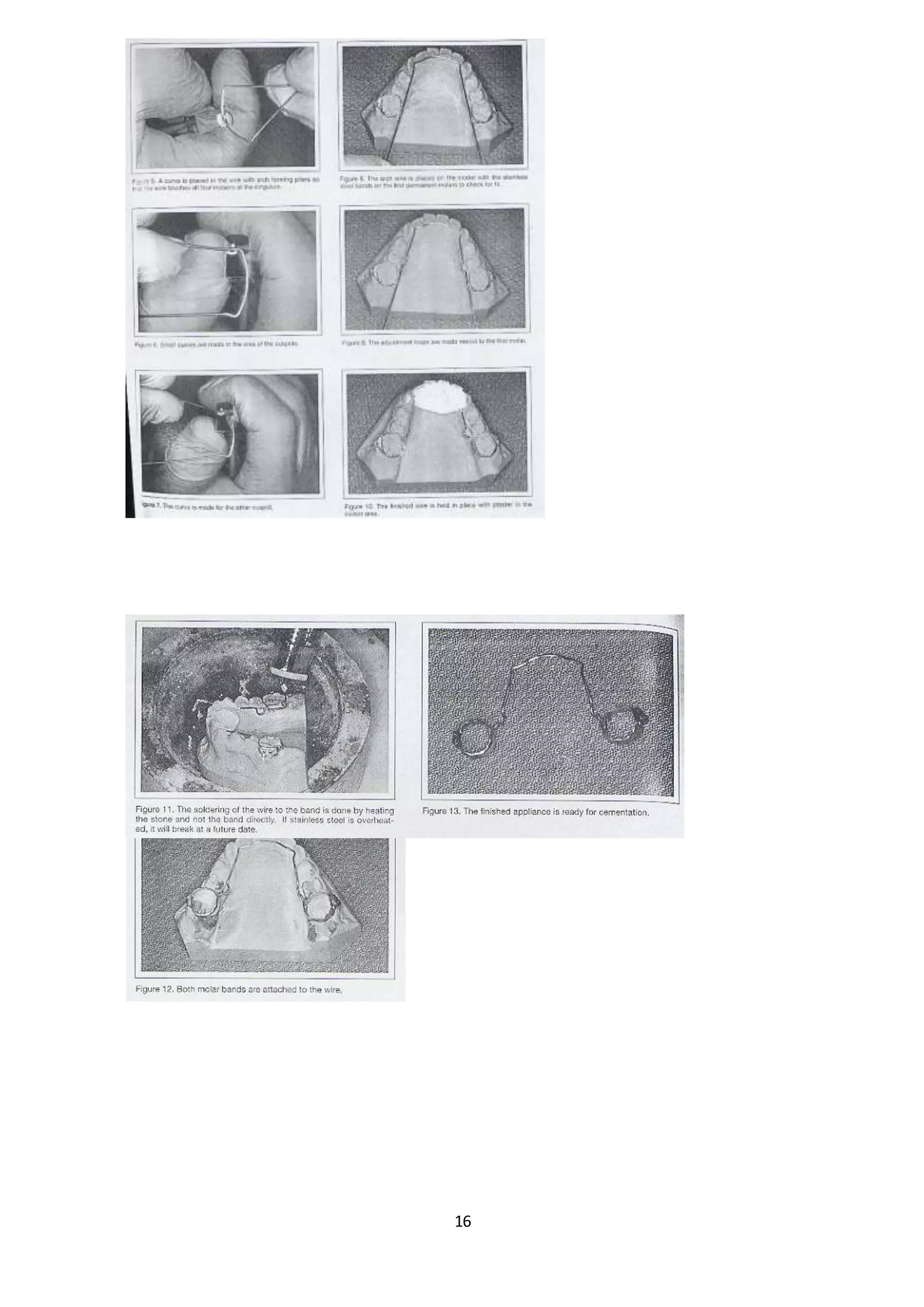 Transpalatal, nance, lingual arch, quadhelix appliances for ...