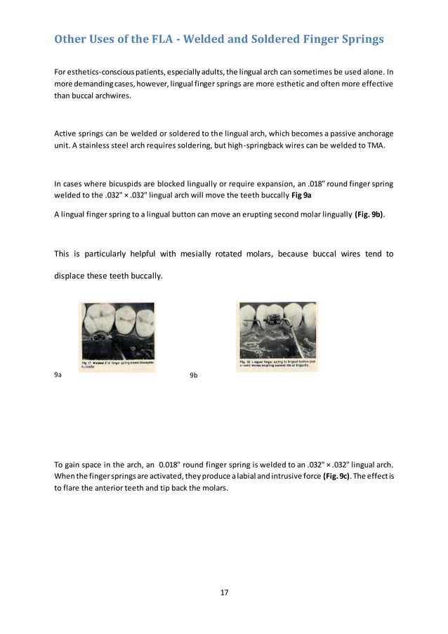 Transpalatal, nance, lingual arch, quadhelix appliances for ...