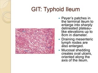 Transparencies and slides identification points | PPTX | Digestive ...