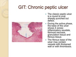 Transparencies and slides identification points | PPTX | Digestive ...