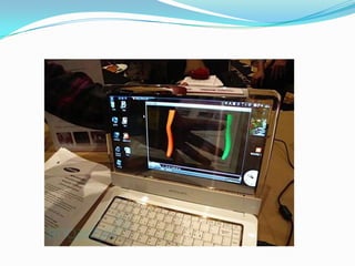 Transparent electronics | PPTX