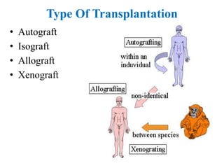 Transplant and tumour immunity | PPTX