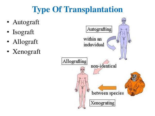 Transplant and tumour immunity
