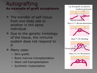 Organ transplantation in immunology lecture .ppt