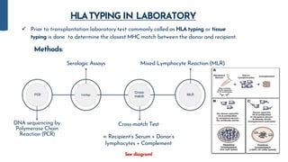 Transplantation-Immunology.pdf