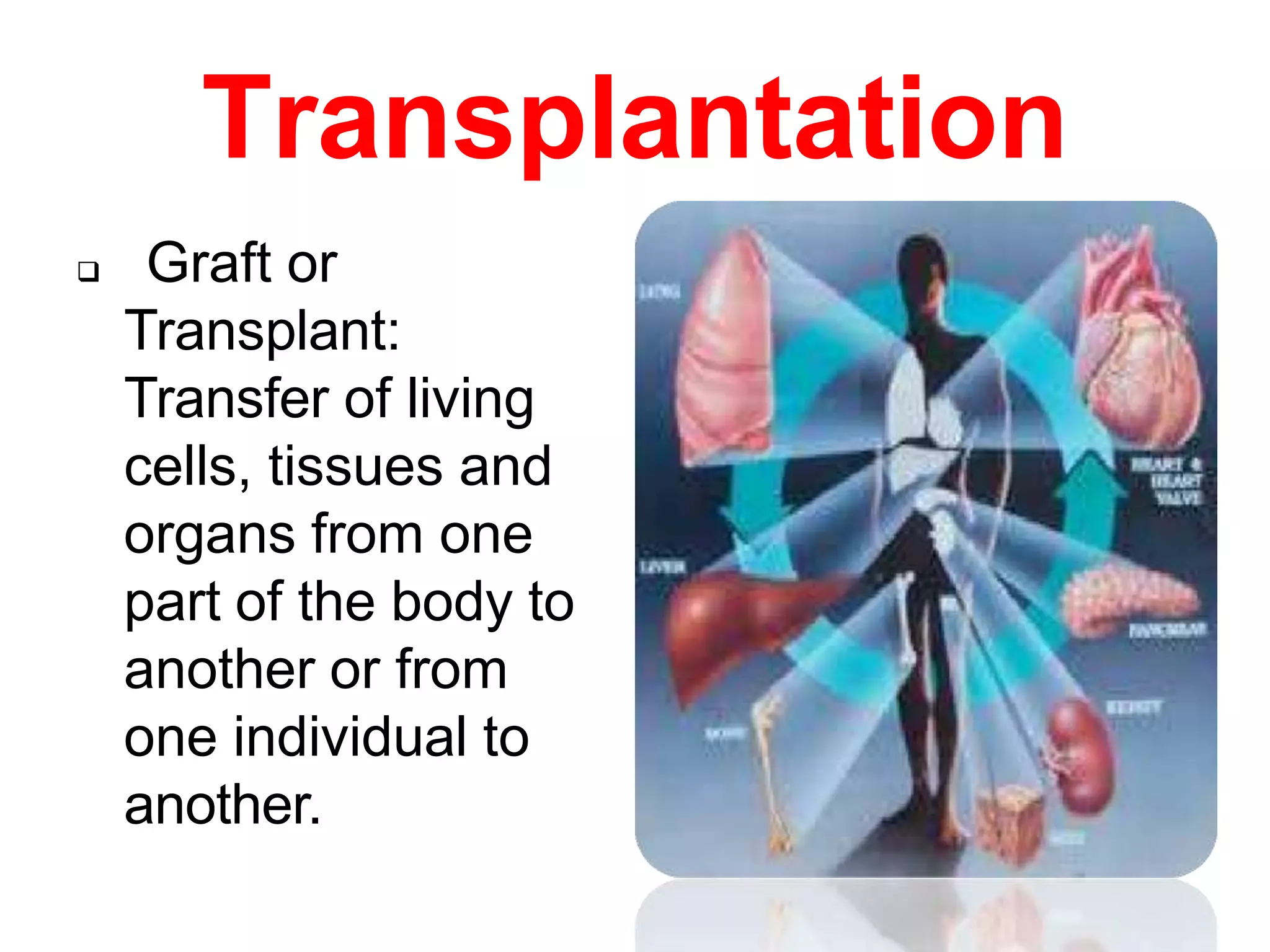 transplantation and immunity.pptx