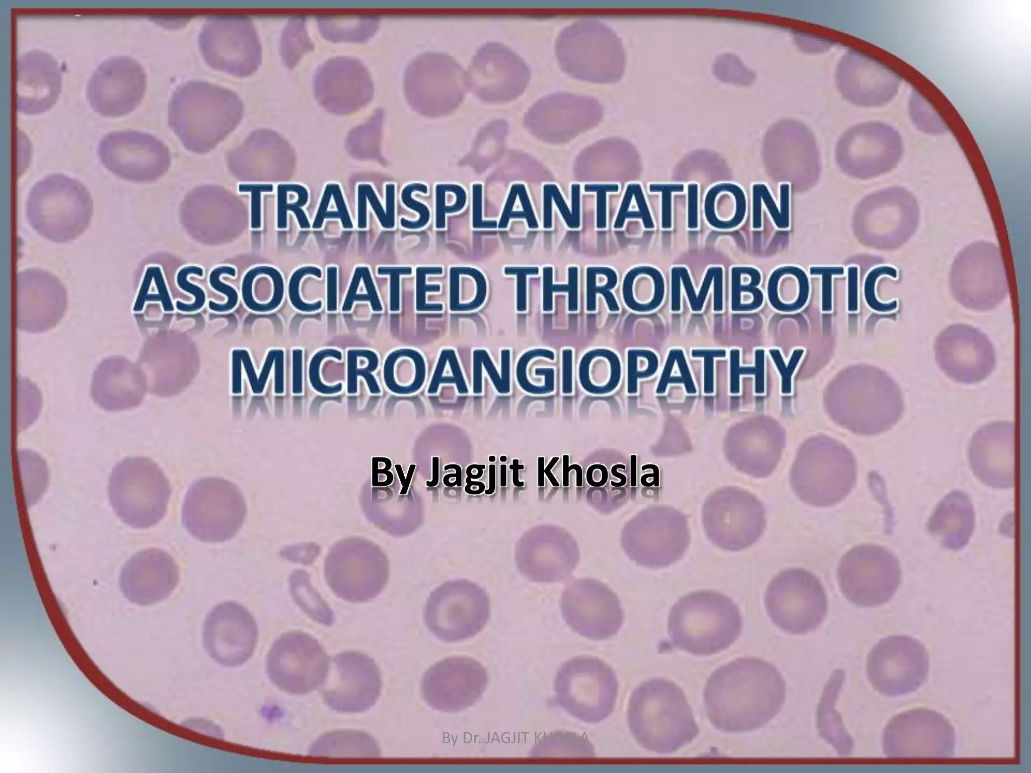 Transplantation associated Thrombotic microangiopathy (TA-TMA) | PPTX