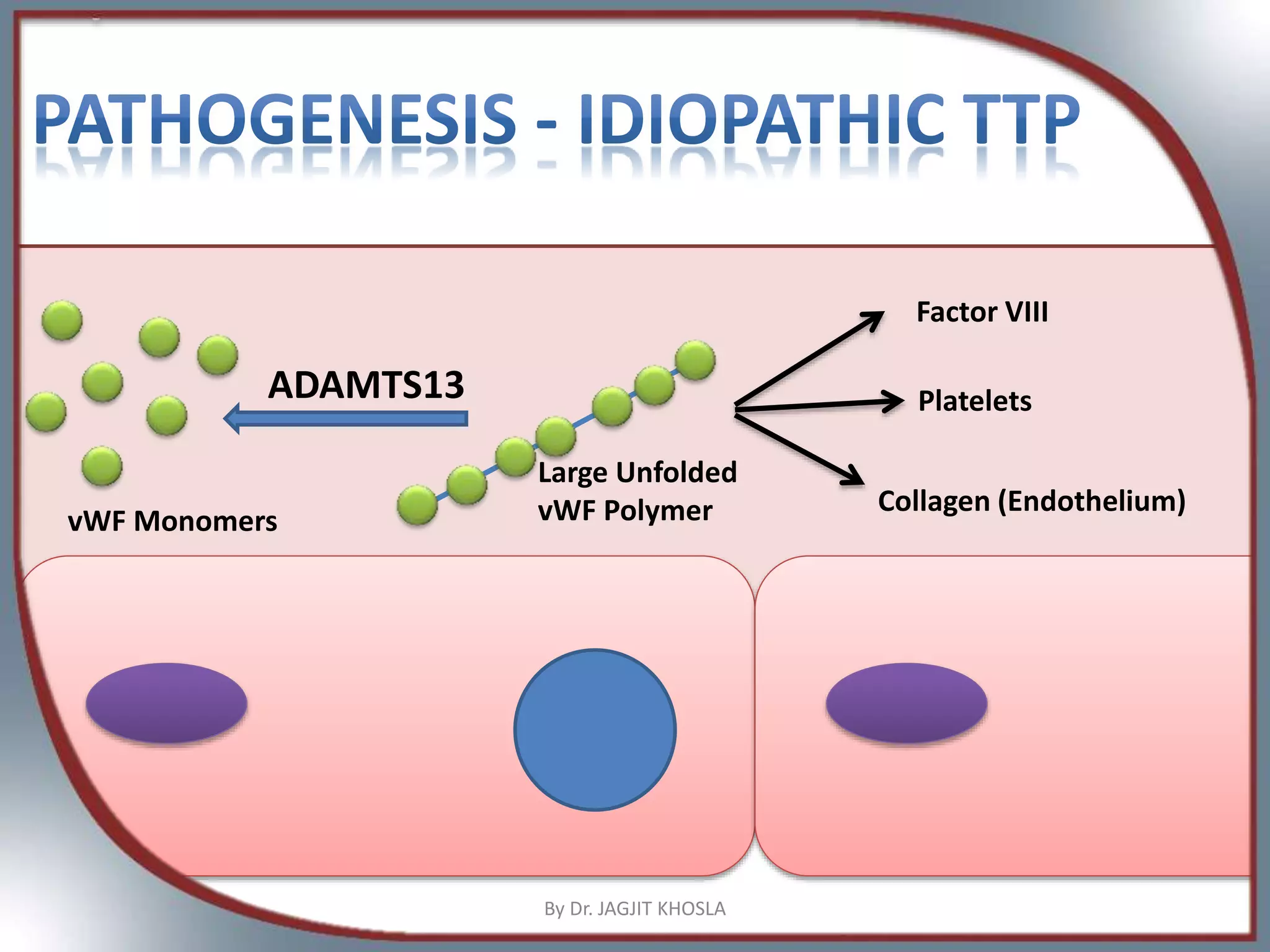 Transplantation associated Thrombotic microangiopathy (TA-TMA) | PPTX