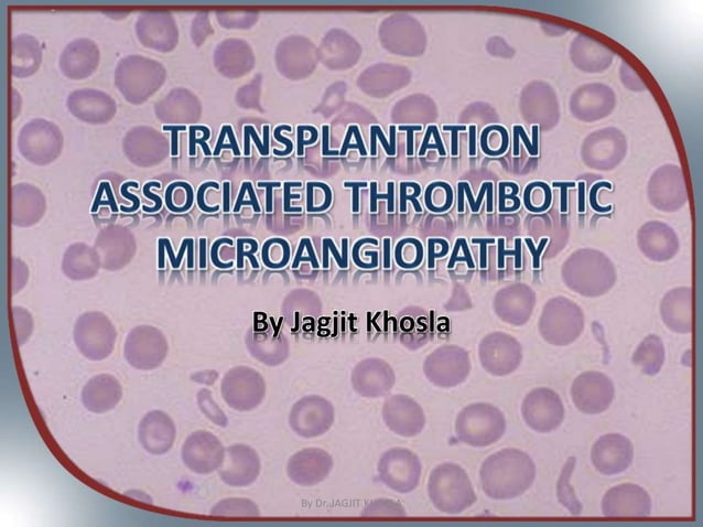 Transplantation associated Thrombotic microangiopathy (TA-TMA) | PPTX ...