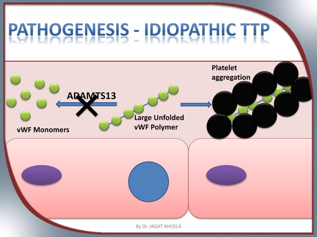 Transplantation associated Thrombotic microangiopathy (TA-TMA) | PPT