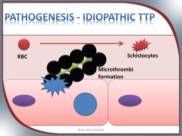 Transplantation associated Thrombotic microangiopathy (TA-TMA) | PPTX ...