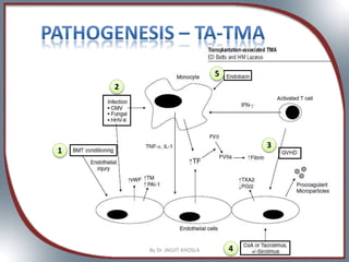 Transplantation associated Thrombotic microangiopathy (TA-TMA) | PPTX