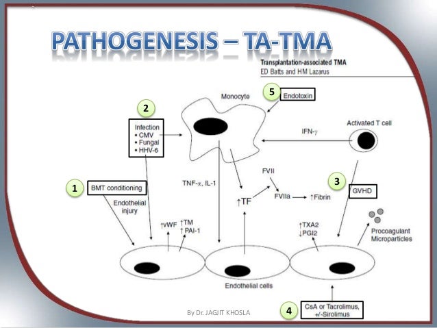 Transplantation associated Thrombotic microangiopathy (TA-TMA)