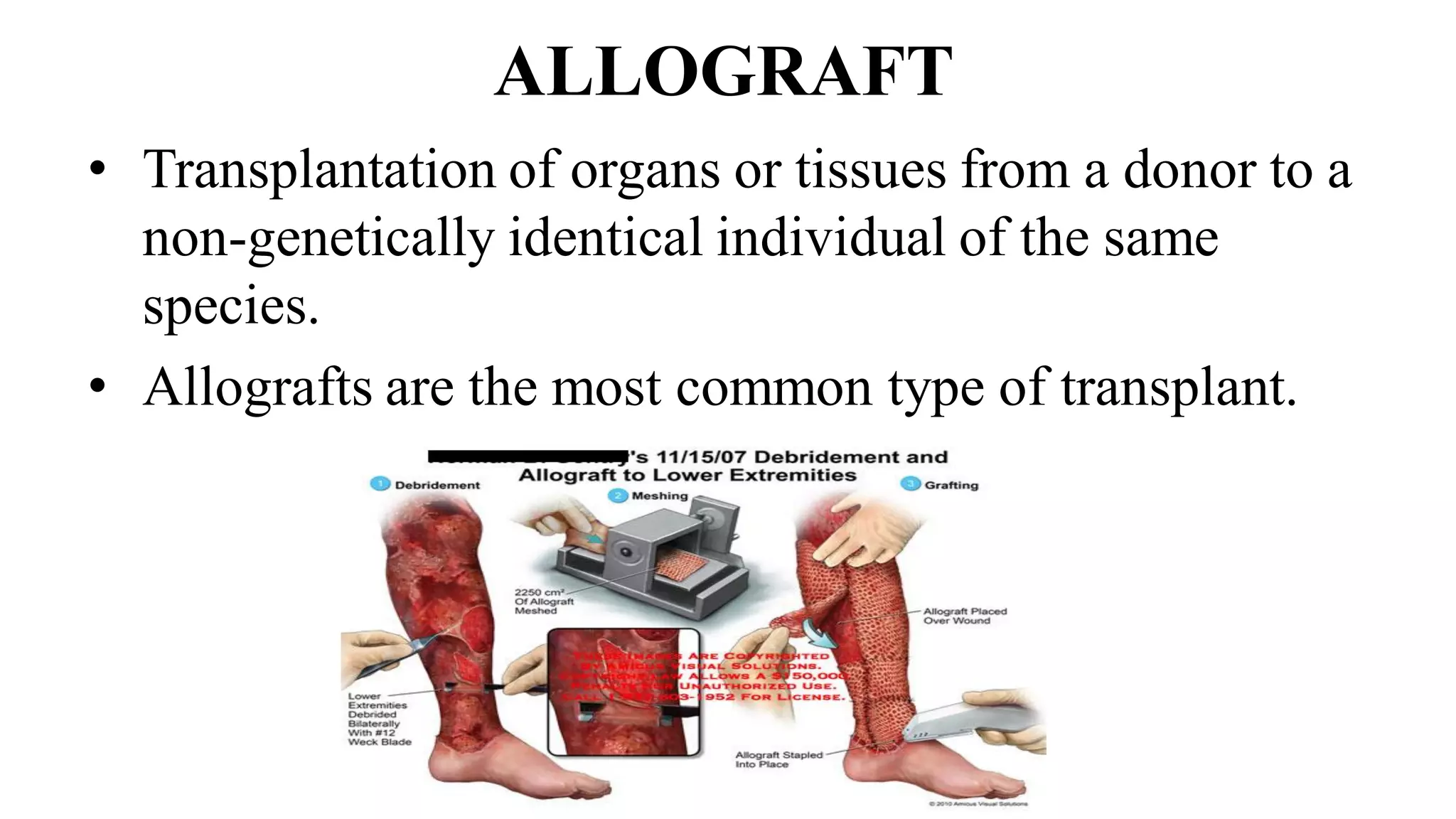 Transplantation immunology | PDF