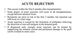 Transplantation immunology | PDF