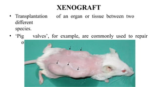 transplantation immunology: an overview.pptx