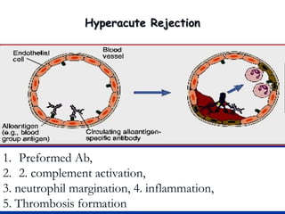 Lesson on Transplantation immunology .ppt