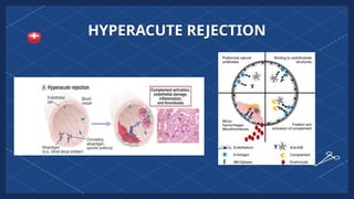 Transplantation Immunology and Pathology | PPTX