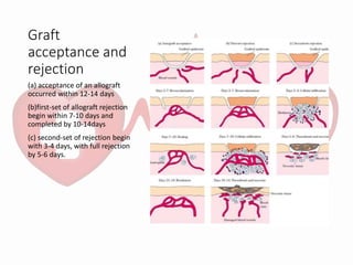 Transplantation immunology(11081) | PPT
